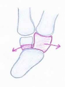 Arthrose des Daumensattelgelenkes – Rhizarthrose – Zentrum für ...